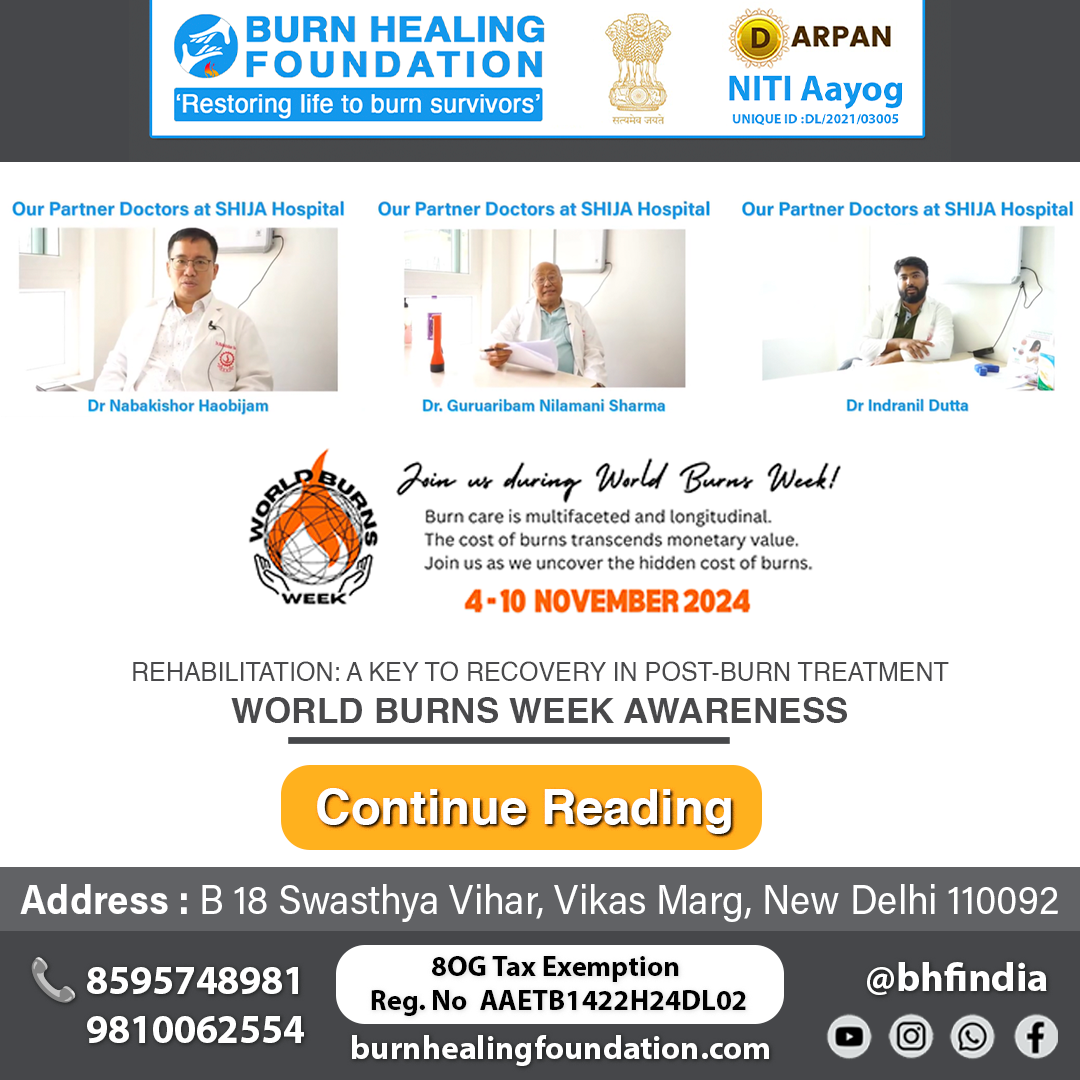 Rehabilitation: A Key to Recovery in Post-Burn Treatment - Burn Healing ...